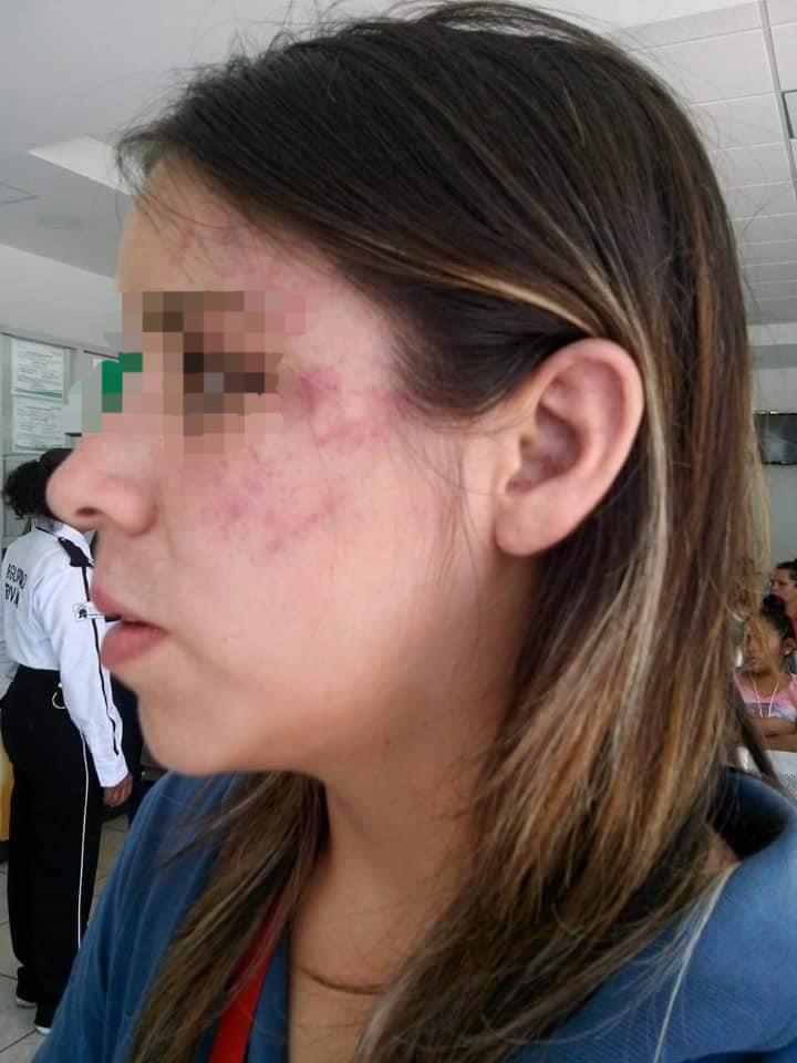 Sufre Amenazas Paulina Víctima De Violencia De Género